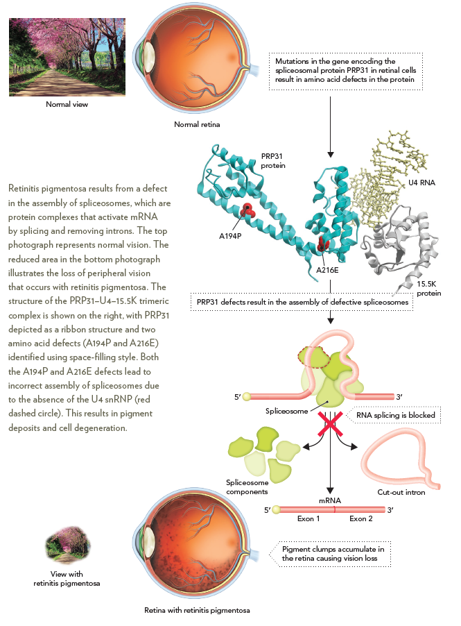 RNA Splicing Defects and Blindness – Everyday BioChem